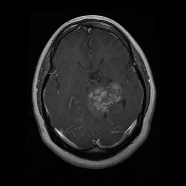 How to Use the yolov8_brt Instance Segmentation API