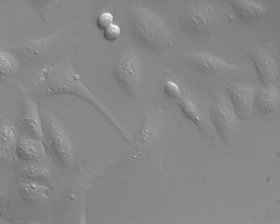 mitosis Object Detection Dataset by detectrondataset