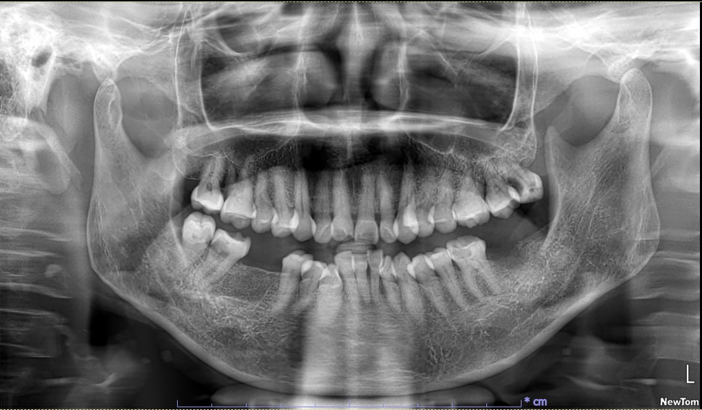 perio_class Object Detection Dataset by uklid.y@gmail.com