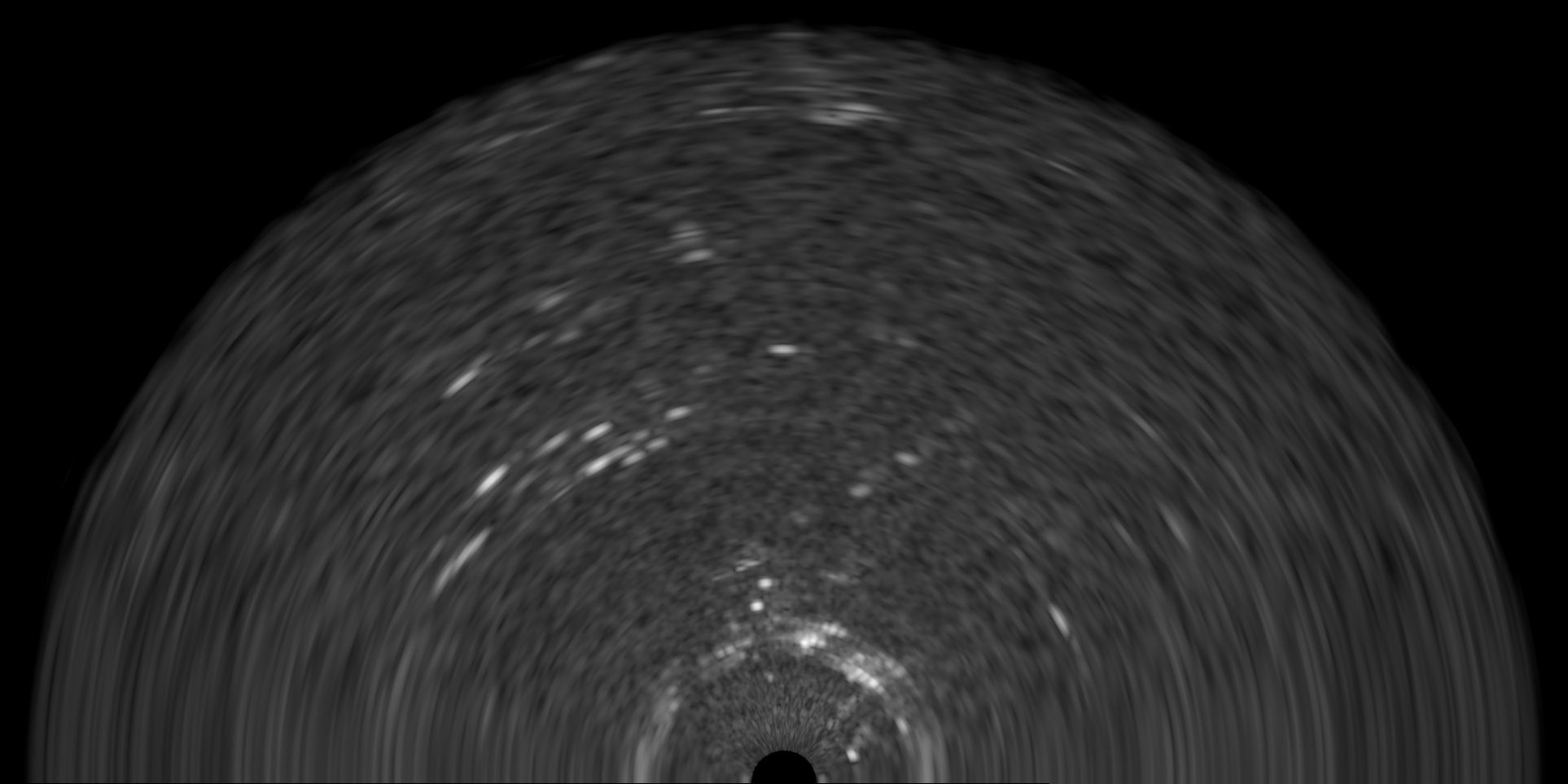 Radar Image Set 7500-9000 Object Detection Dataset by Undergrad ...