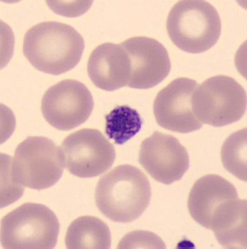 wbcs-5-classes Object Detection Dataset and Pre-Trained Model by WBC classification