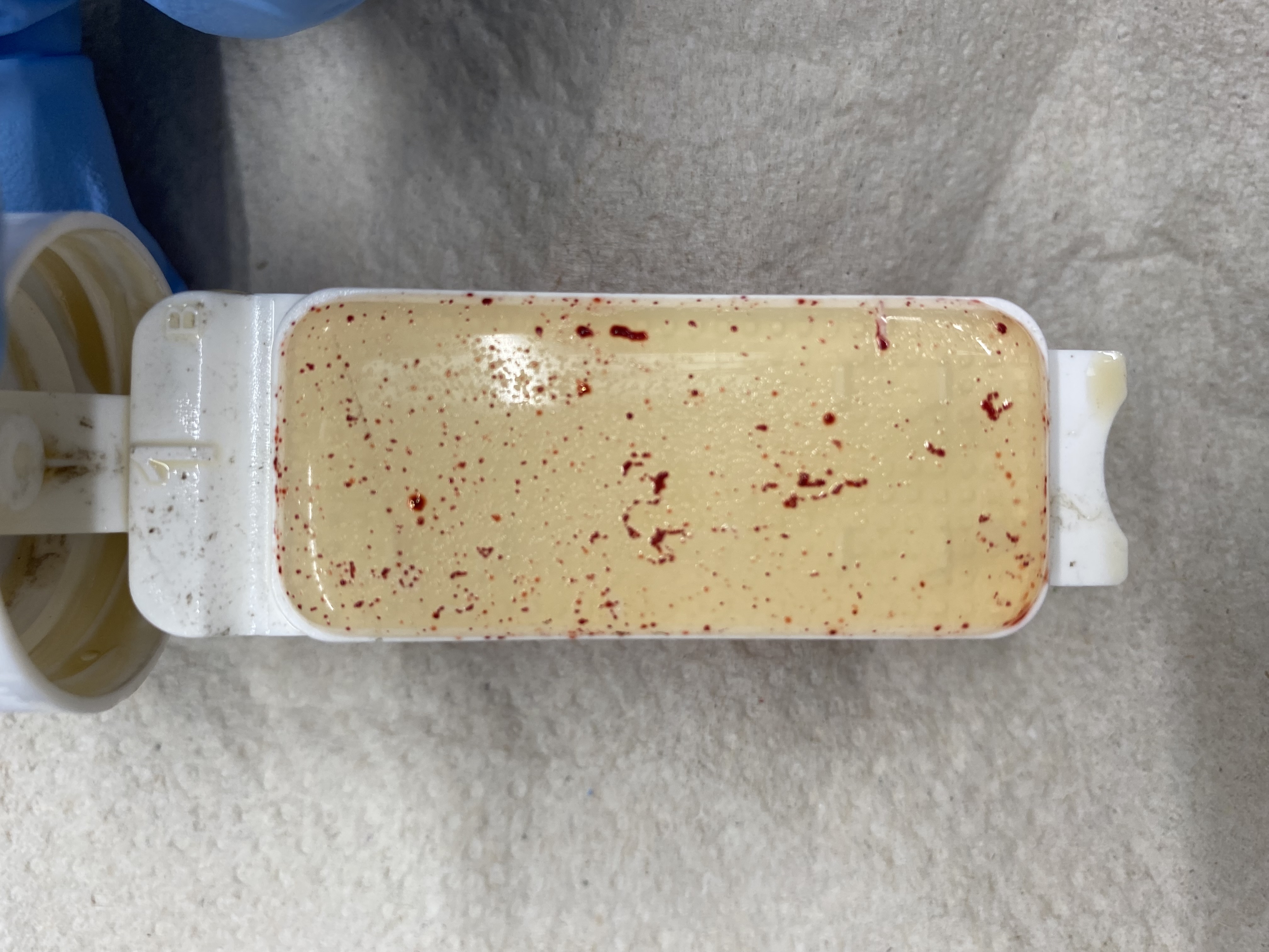 Dip-Slides Object Detection Dataset and Pre-Trained Model by Masterarbeit