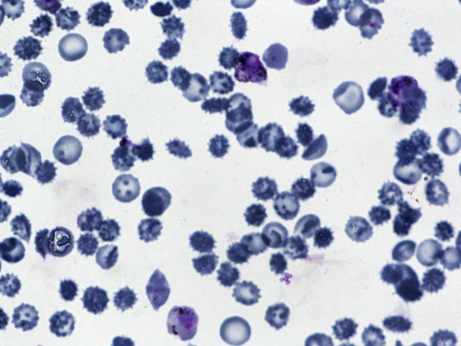 p.vivax_test Object Detection Dataset by t109598099@ntut.org.tw