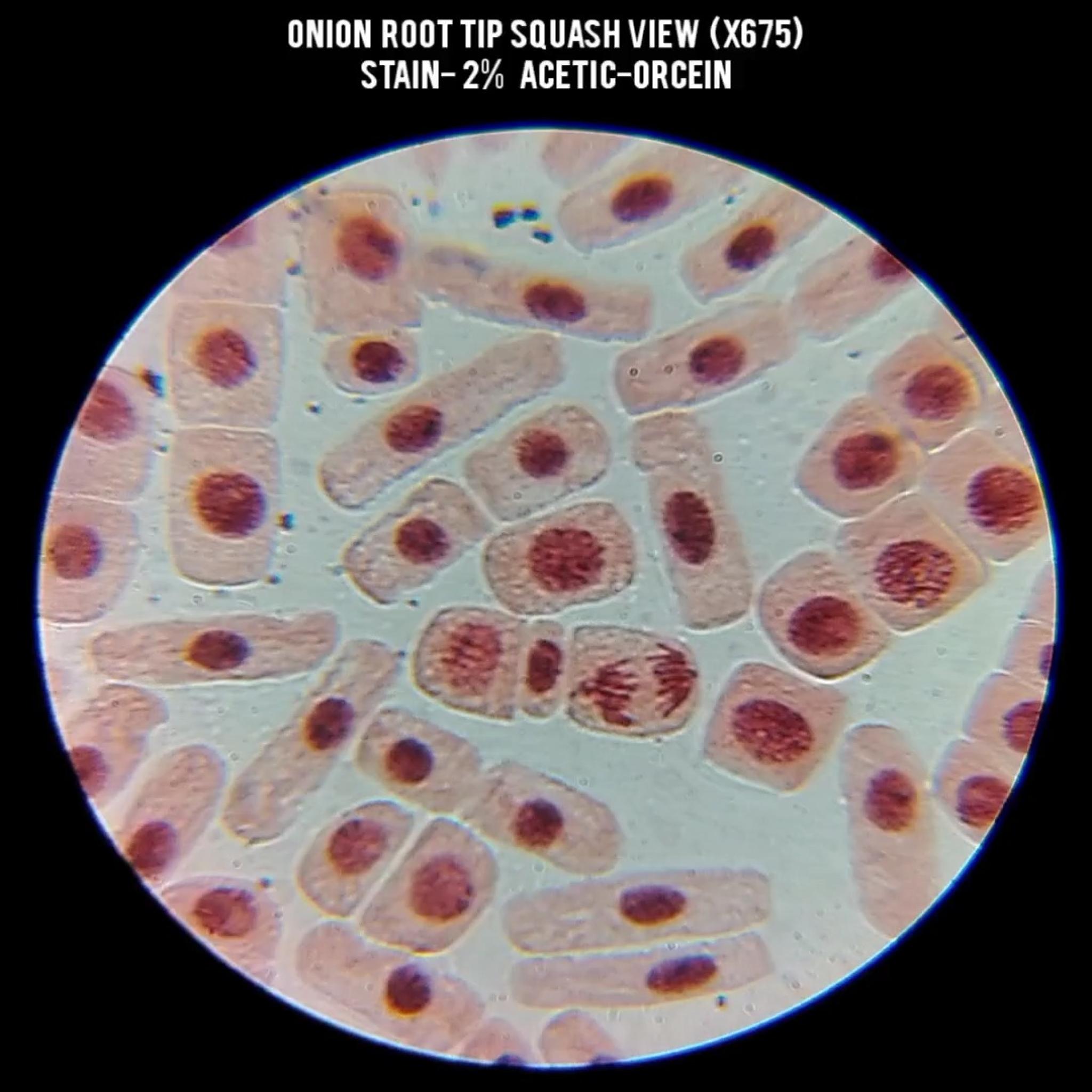 How to Use the Onion-Cell-Merged-v5 Object Detection API