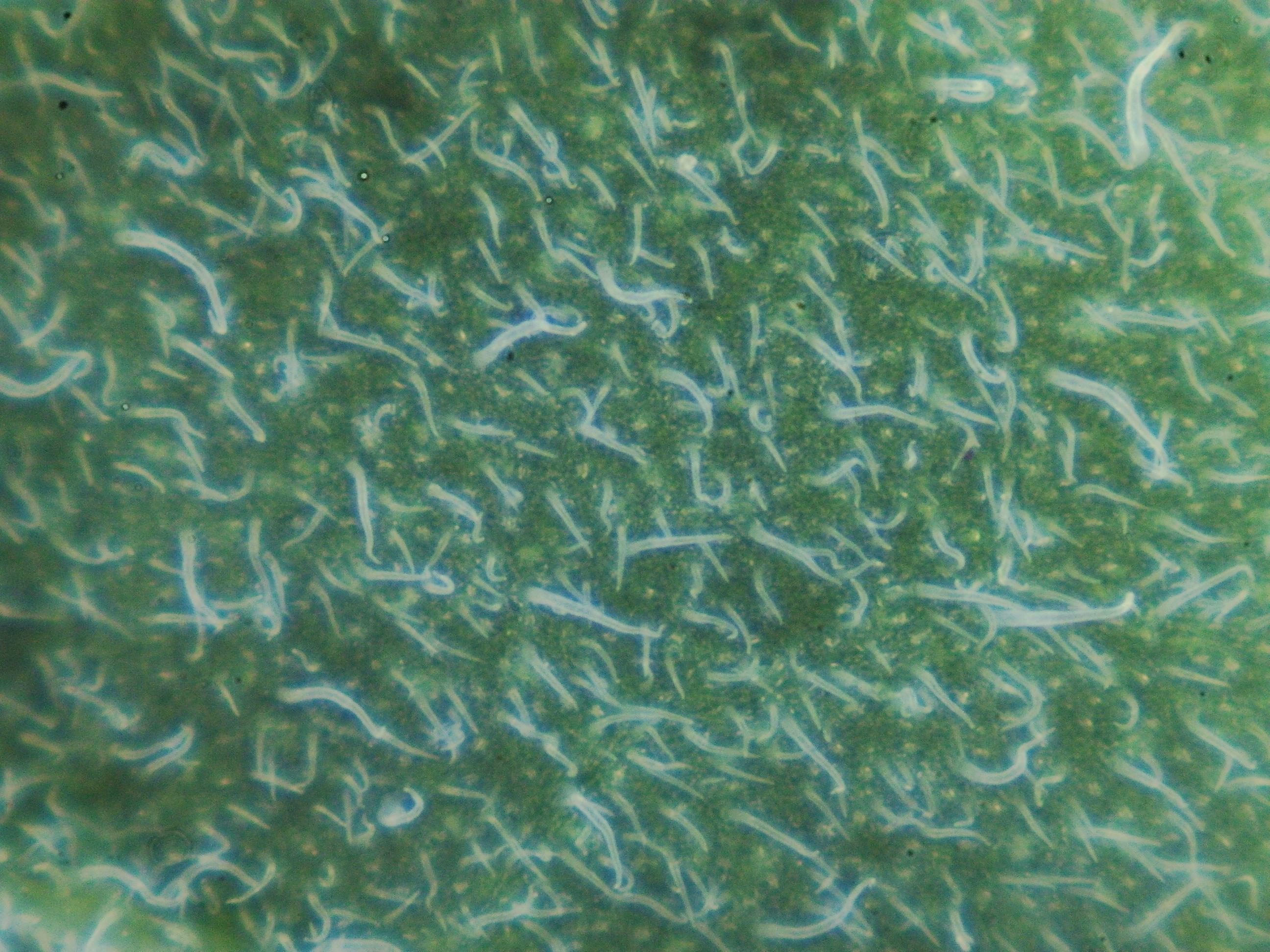 Trichome Chilense Object Detection Dataset And Pre Trained Model By