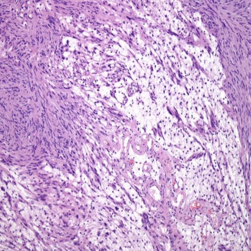 Soft Tissue Classifier Classification Dataset and Pre-Trained Model by ...