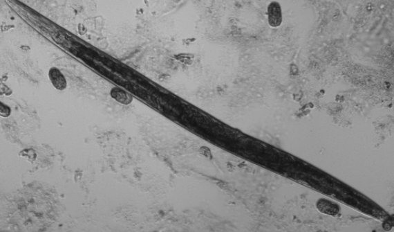 WormScape Conversion Object Detection Dataset by Baylor College of Medicine