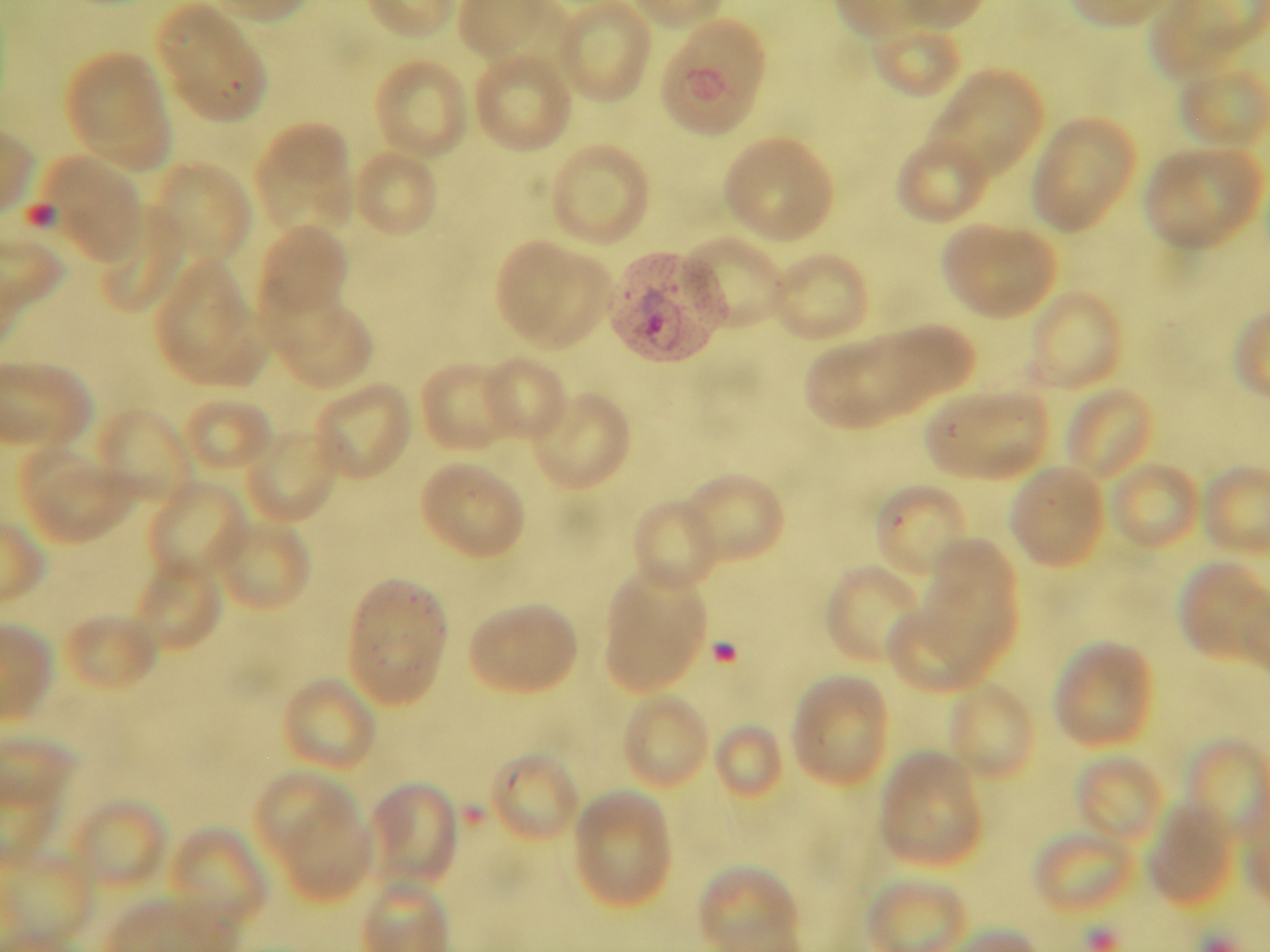 Malaria Diagmal Object Detection Dataset By Malariasystem