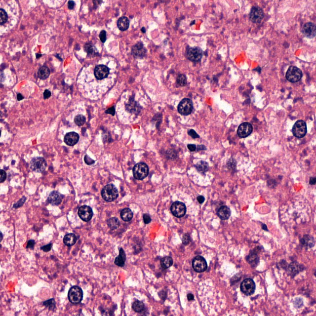 How to Use the liver cell Object Detection API