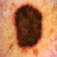 YOLOv8 on Cancer-detection Instance Segmentation Dataset and Pre-Trained Model by Bach Khoa Ho ...