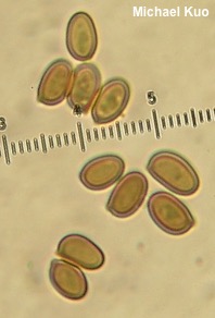 Mushroom Spore Object Detection Dataset by Mushroom