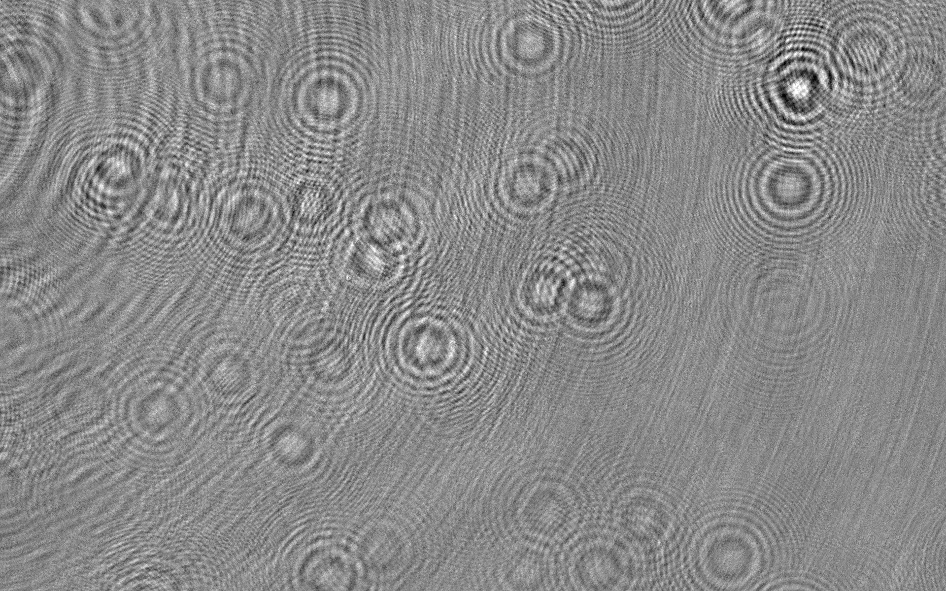 Ecoli 40x Allplane Object Detection Dataset By Lei Feng