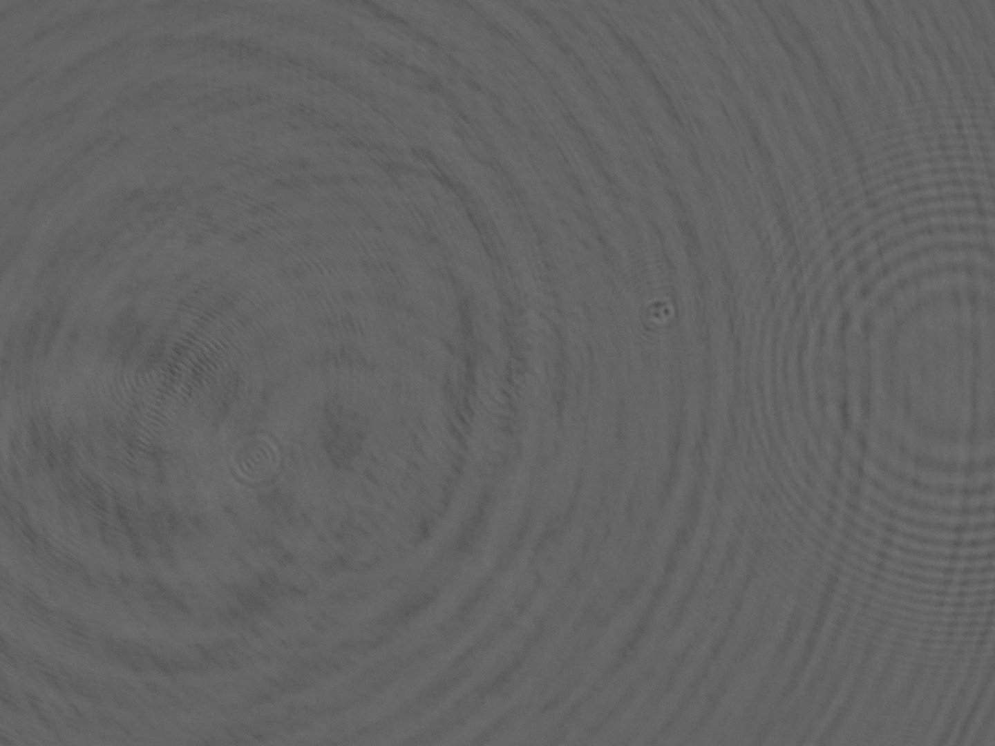 Enterococcus 40x Object Detection Dataset By Lei Feng