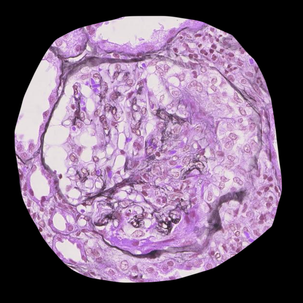 Glom Classif No Bg Classification Dataset V1 2022 08 25 10 24am By
