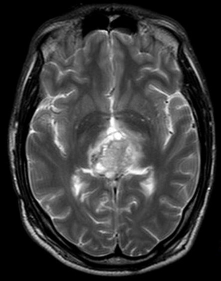 VIT_V2 Classification Dataset and Pre-Trained Model by Deepak