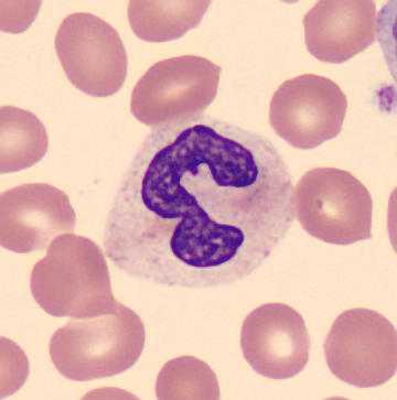 Resnet Classification Dataset by Resnet