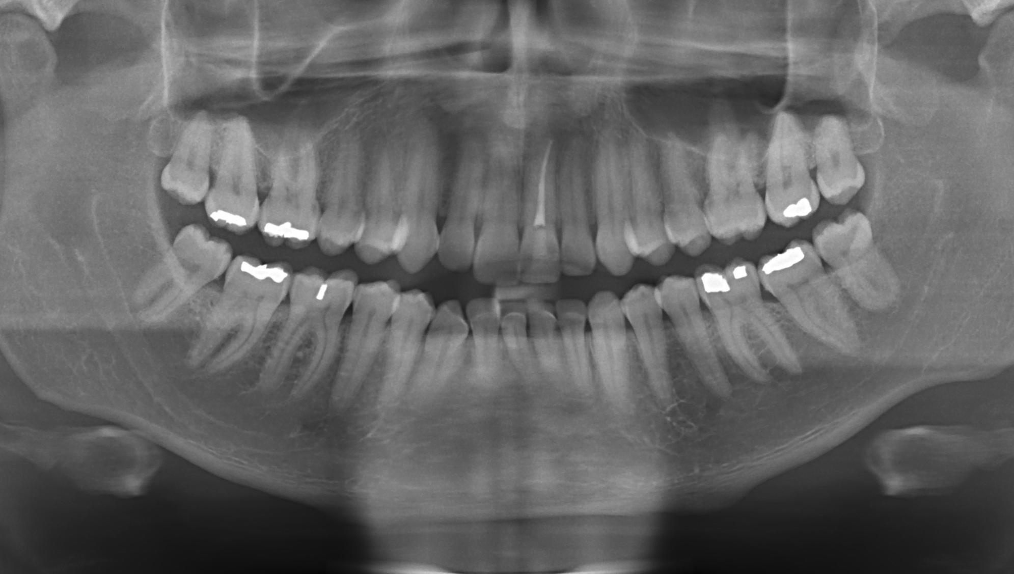 manmax Instance Segmentation Dataset by uob