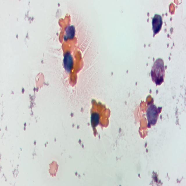 How To Use The Ls 2024 Monocytes Object Detection Api