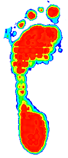 Plantar Foot Pressure Object Detection Dataset (v1, 2023-03-08 6:46am ...