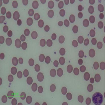 How to Use the bccd-yolov5 Object Detection API