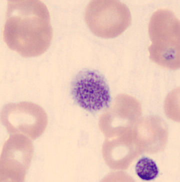 WBC classification Object Detection Dataset and Pre-Trained Model by Duke AIPI 540 summer 2023