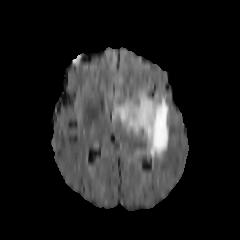 automatic identification and classification of brain tumor. Object ...