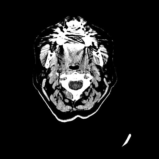 How to Use the Tumor,Cancer,Aneurysm Detection Classification API