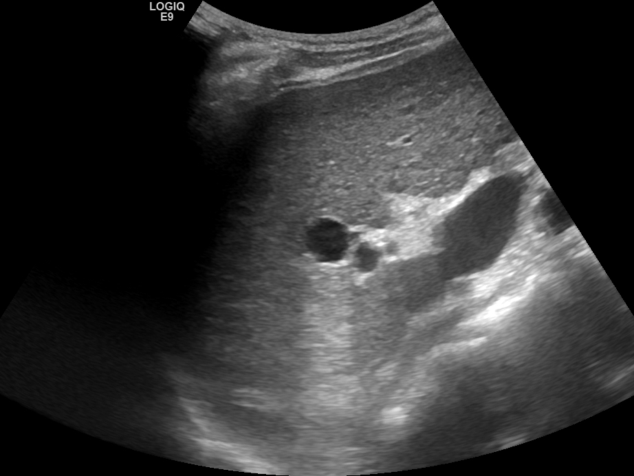 How to Use the liver lesion detection Object Detection API