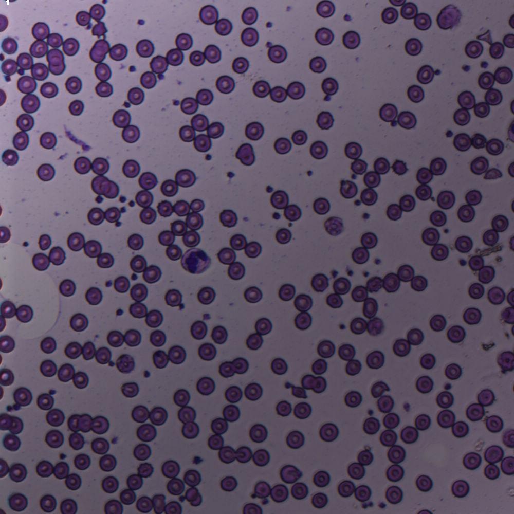 WBC Object Detection Dataset by Devora Weintraub