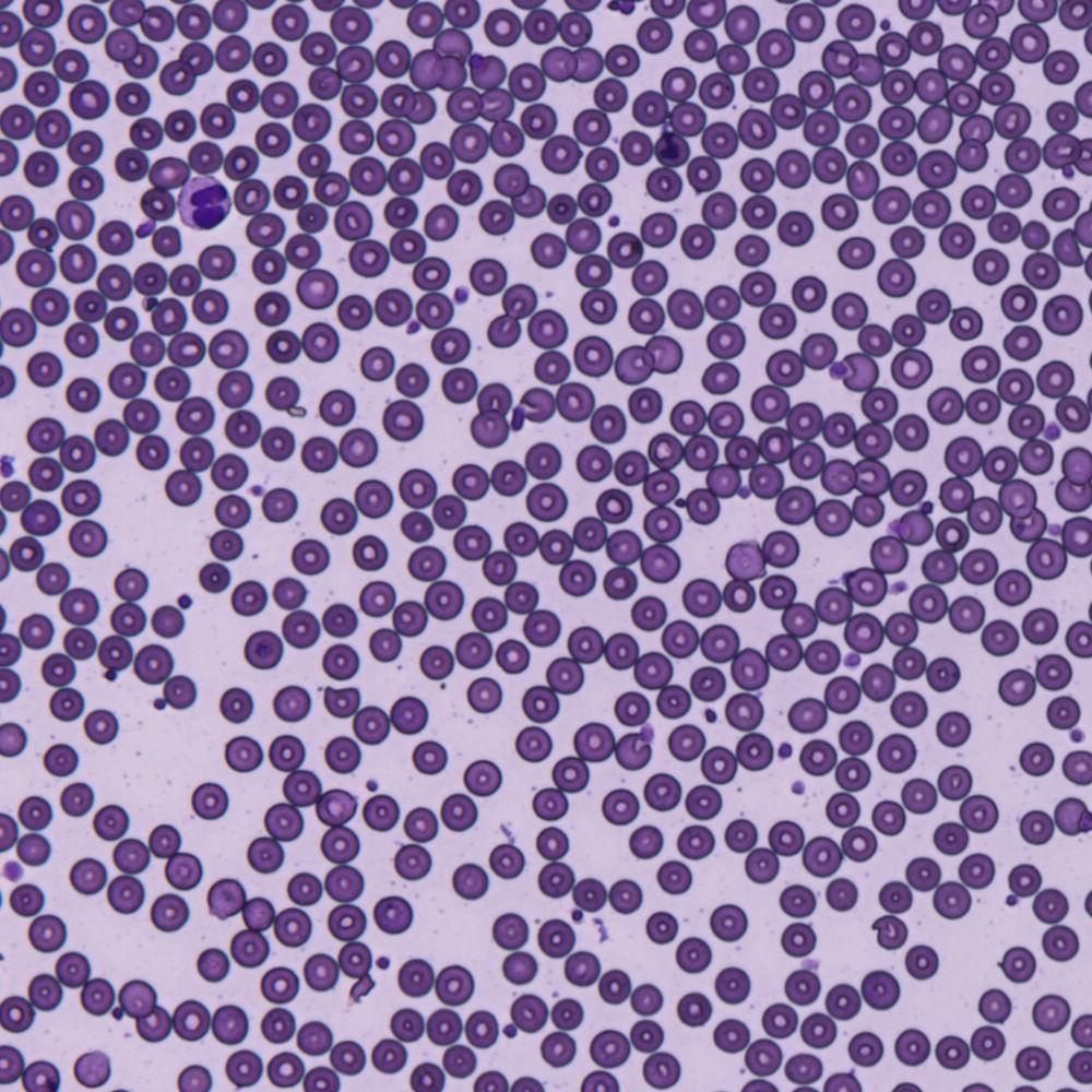 New WBC Object Detection Dataset by Devora Weintraub