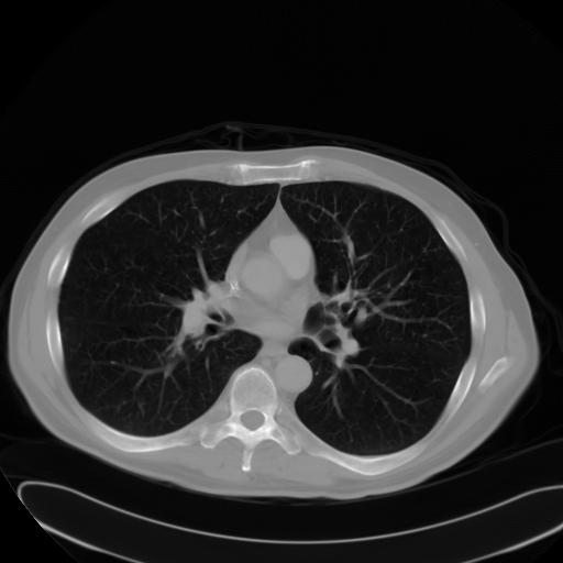 image dicom Object Detection Dataset by automatique et informatique ...
