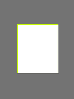 Cervical Cancer Object Detection Dataset and Pre-Trained Model by Taylors
