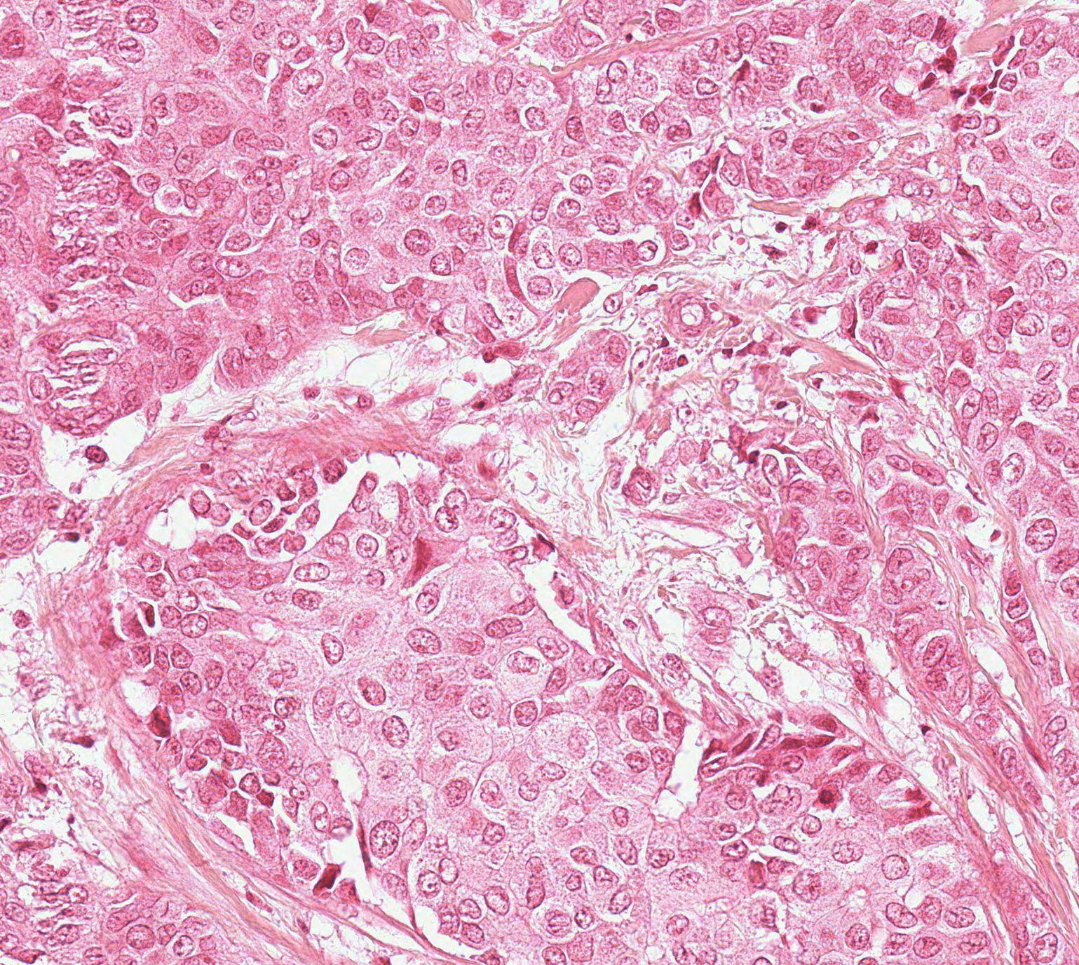 mitosis_test Object Detection Dataset and Pre-Trained Model by ...