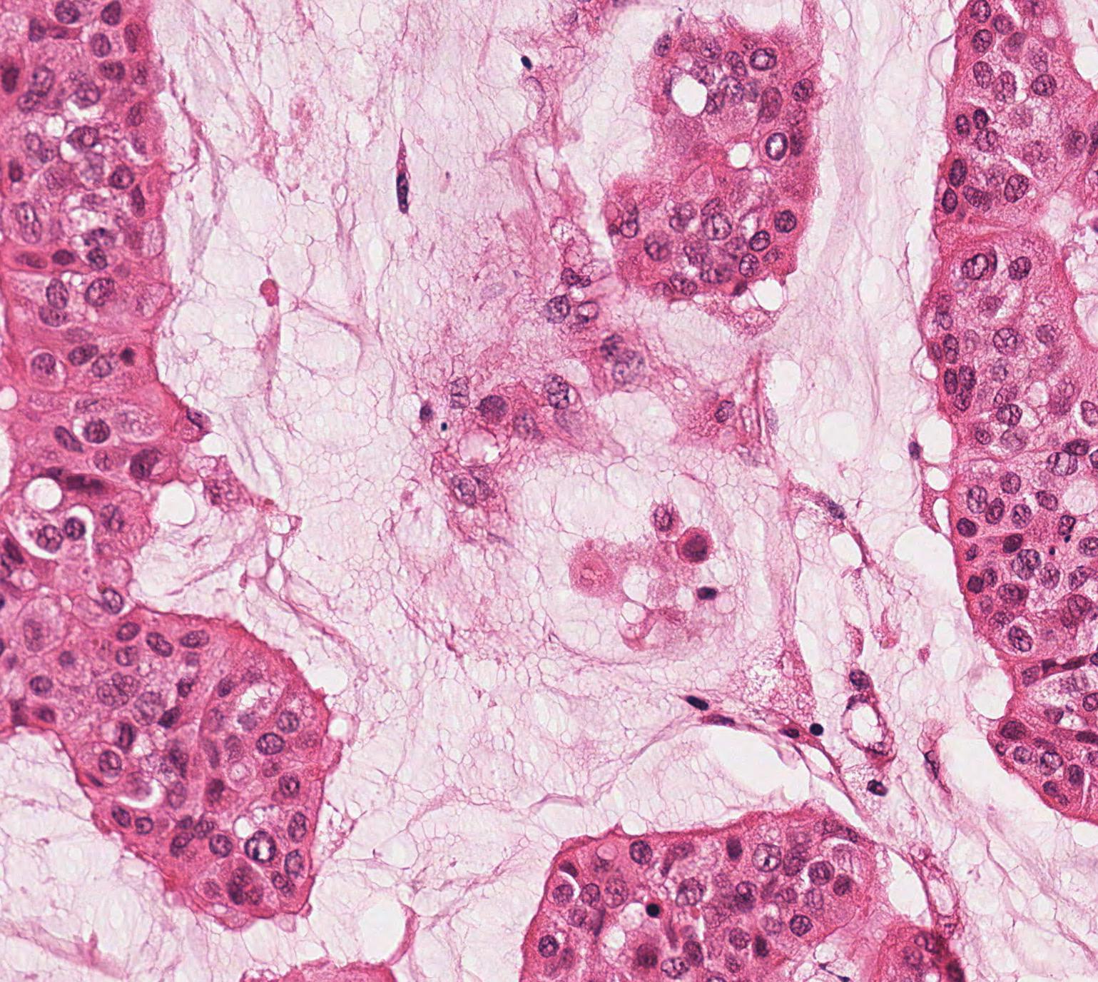 ms-mitosis-detection2 Object Detection Dataset by Mitosisdetection ms-mitosis-detection2 Object Detection Dataset by Mitosisdetection