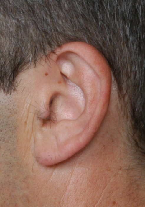 How to Use the Ear Object Detection API