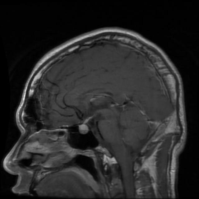 Brain Classification Dataset and Pre-Trained Model by H452