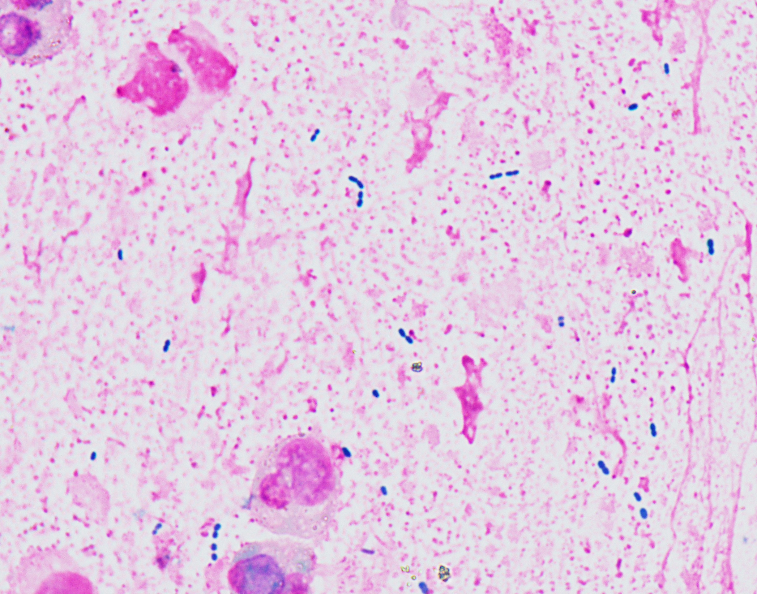 str_pne_3types Object Detection Dataset by terada shoma