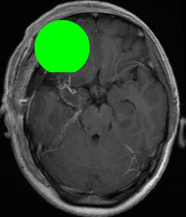 Brain detection Object Detection Dataset by Brain detection