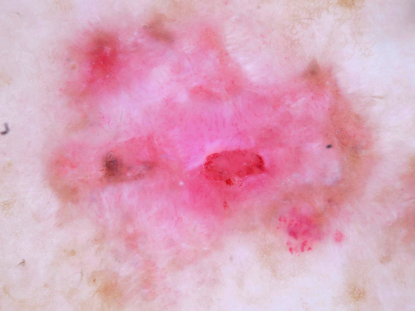 Skin-Disease-Multilabel Classification Dataset by LUMS