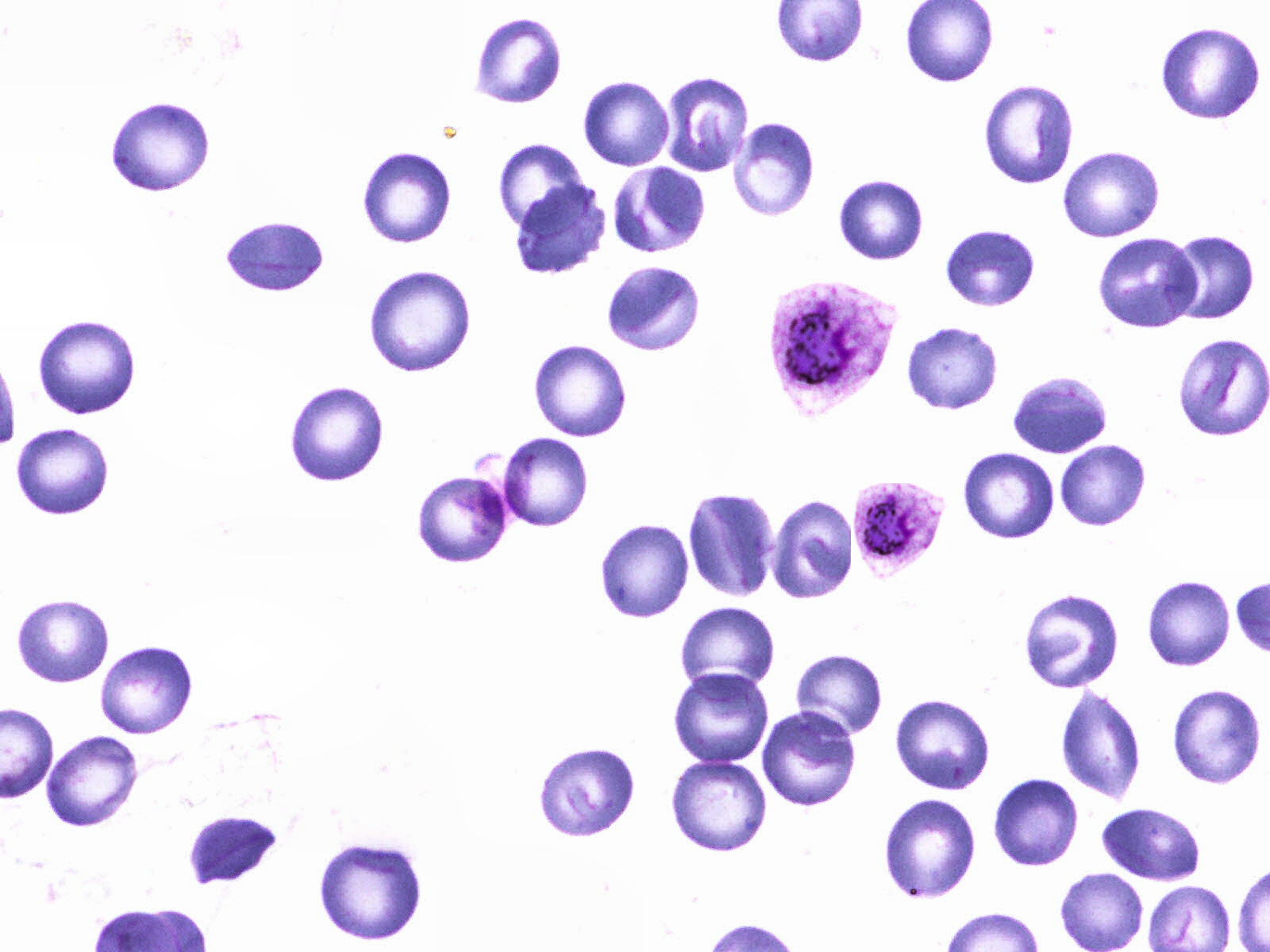 Malaria Prueba Object Detection Dataset by TFG