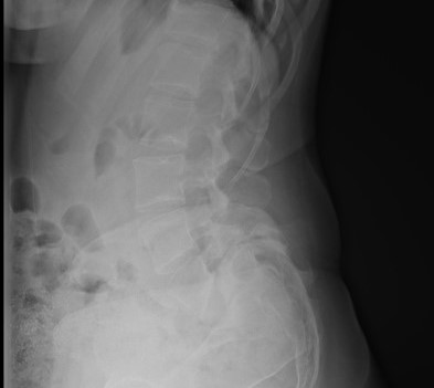 asdfasdf (asdfasdf-u5tsl) - Roboflow Universe