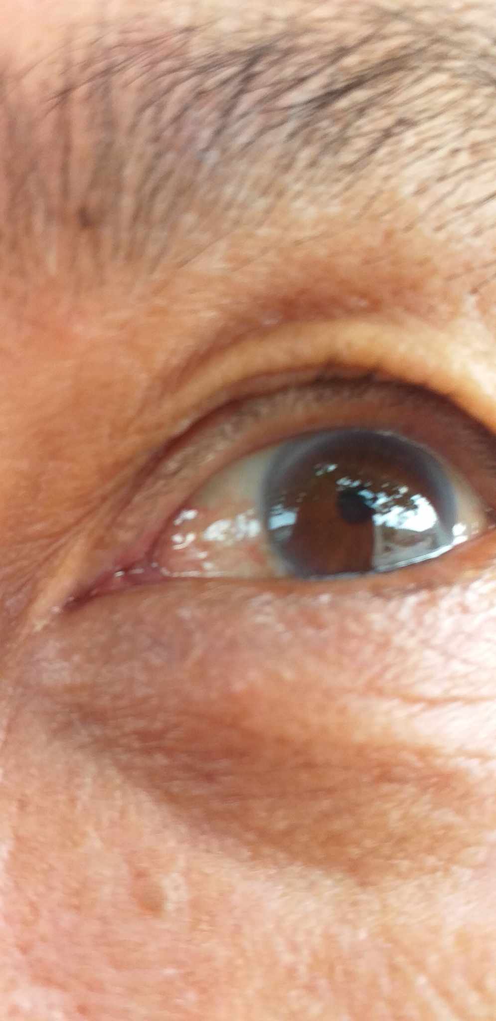 Fake Iris Detection Object Detection Dataset and Pre-Trained Model by Thesis