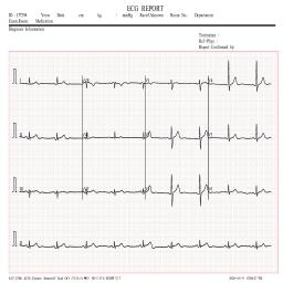 heart ecg images Classification Dataset by Devanshu