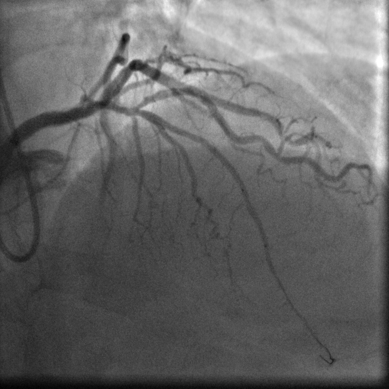 anjio Instance Segmentation Dataset by Akdeniz niversitesi