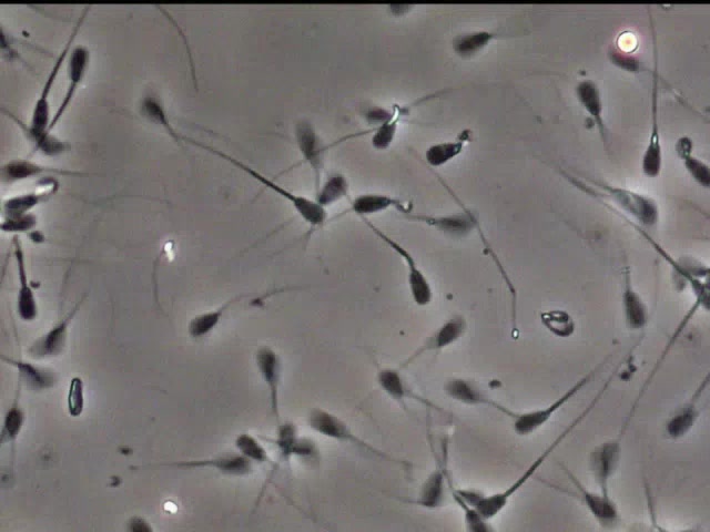 sperm-detection Object Detection Dataset by Golara Refahi