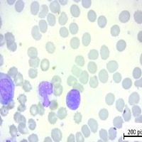 Leukemia Cancer Detection Object Detection Dataset and Pre-Trained ...