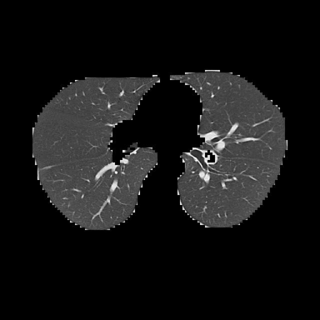 Object Detection Diseases Object Detection Dataset And Pre Trained