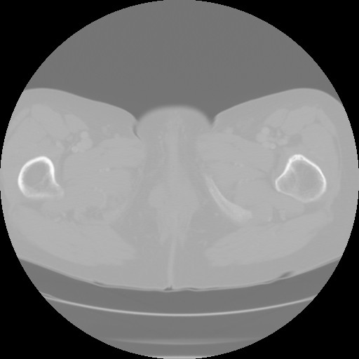 How to Use the Liver Detector Object Detection API