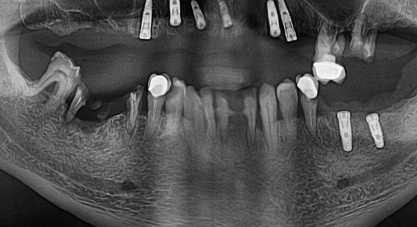 fdsfds Object Detection Dataset by SaSWhyLifeSuck