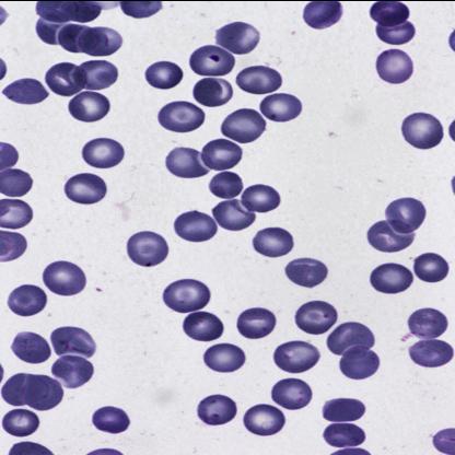 malaria_broadinstitute_relabeled_to_polys Object Detection Dataset by cells